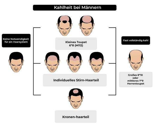 Was verursacht Haarausfall bei Männern und Frauen? - Superhairpieces.de